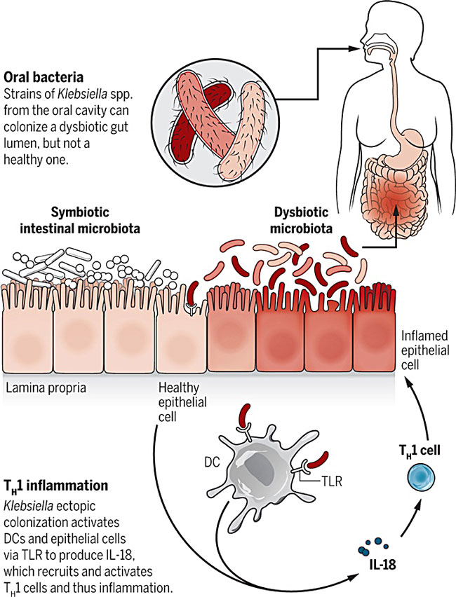 Antibiotics that cover klebsiella